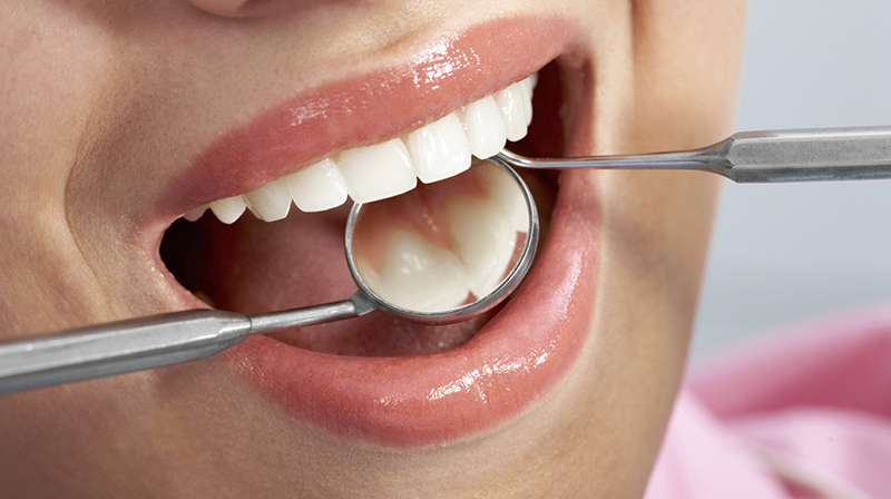 Unleashing the Potential of Dental Mirrors