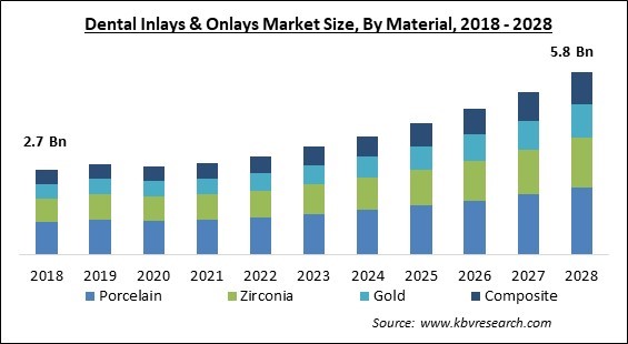 Dental Inlays & Onlays Market Size & Growth Forecast, 2028
