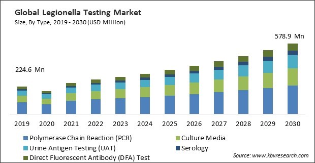 Legionella Testing Market Size & Analysis Report to 2030